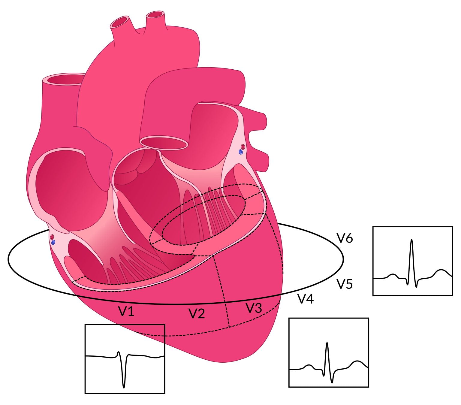 Basisbeginselen ECG | Vragen en uitleg | Geneesleer
