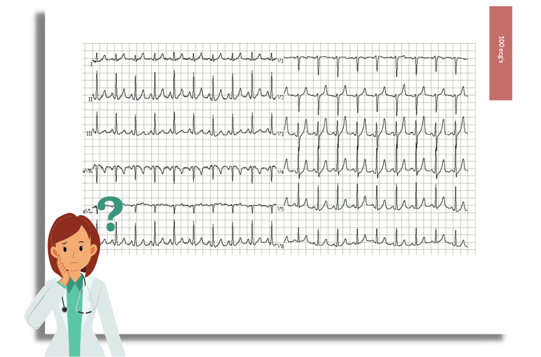100 ecg's met uitleg | Productoverzicht | Geneesleer