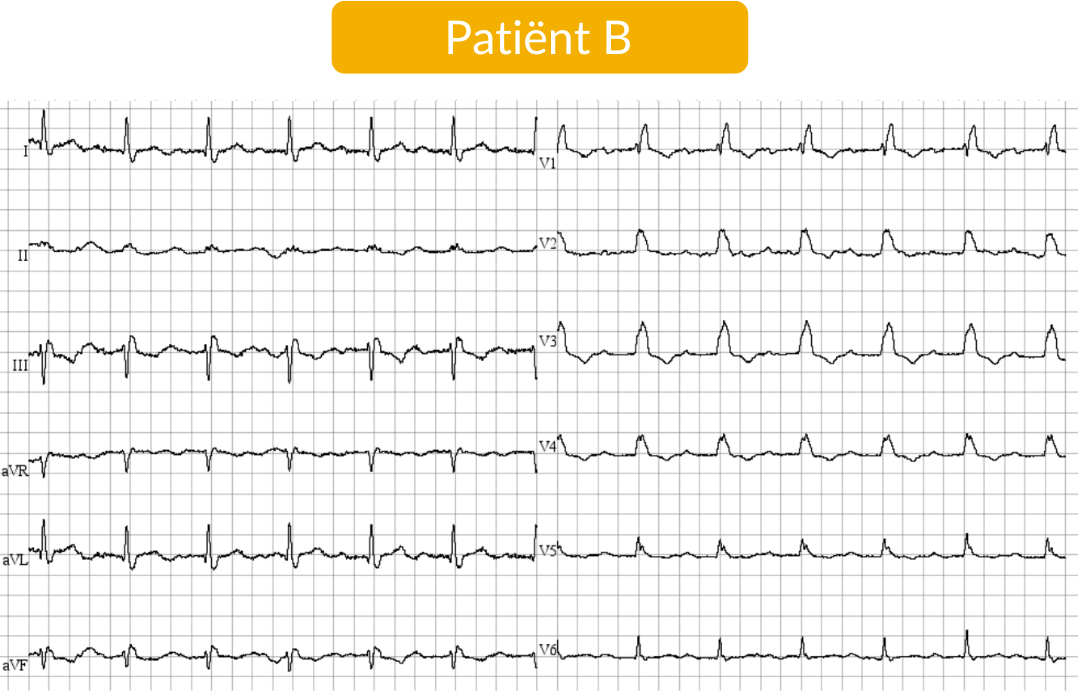 Vragen ECG en hartfalen | Geneesleer